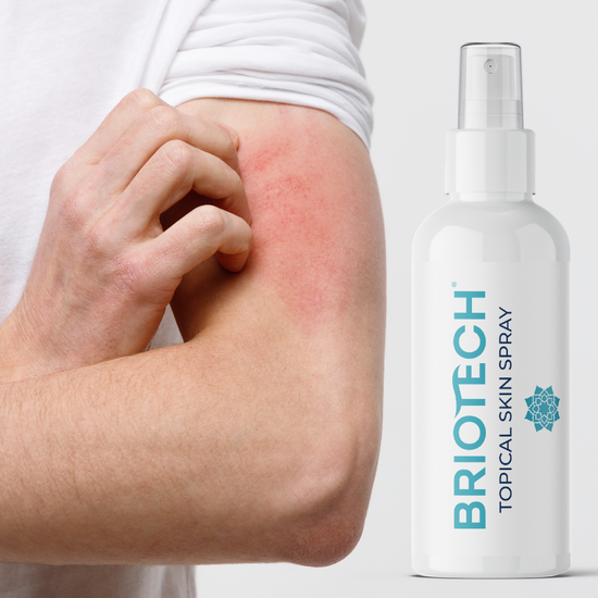 Topical Skin Spray – Briotech EU