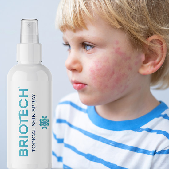Topical Skin Spray – Briotech EU